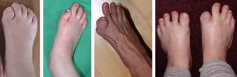 Was ist FOP – FOP e.V.